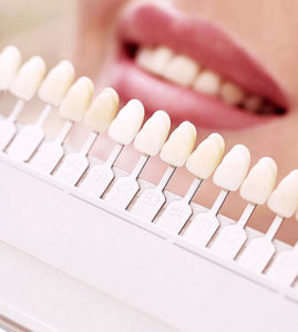 Porcelain Veneers Sydney | Best Affordable Dental Veneers Sydney CBD