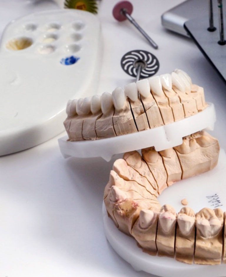 Porcelain Veneers Sydney | Best Affordable Dental Veneers Sydney CBD